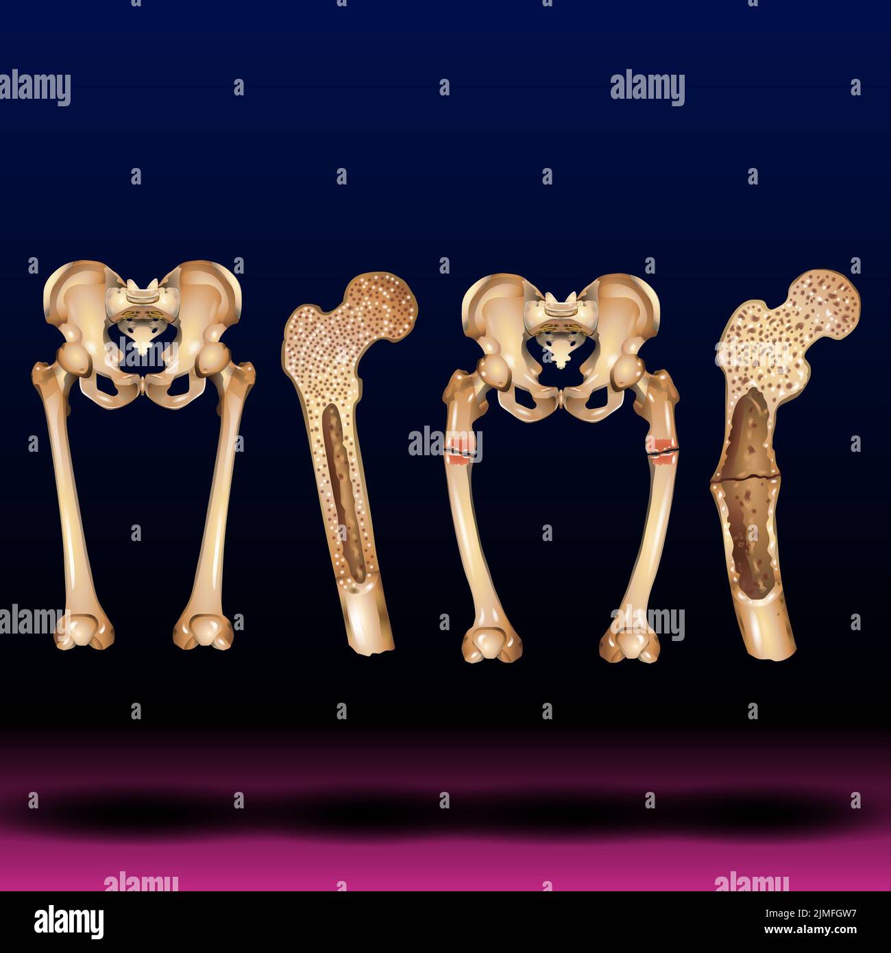 Struktur des Beckens. Anatomisches Poster des menschlichen Skeletts ...
