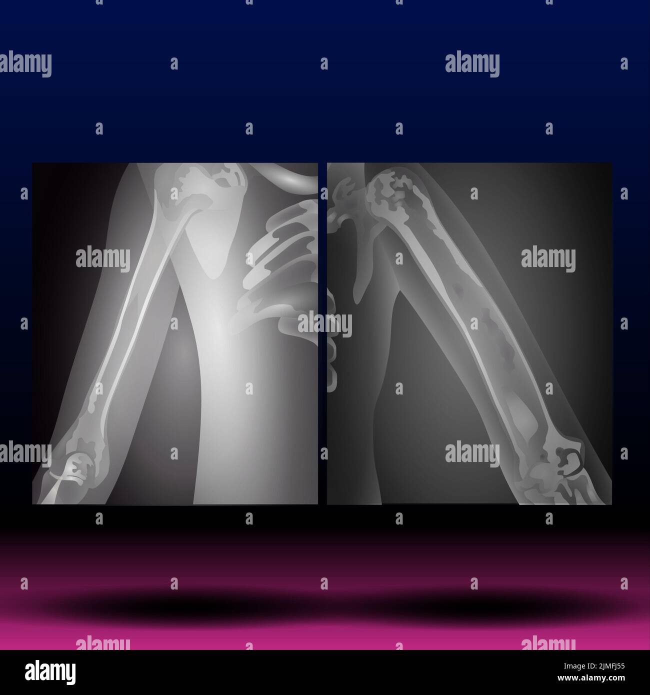 Upper limbs anatomy -Fotos und -Bildmaterial in hoher Auflösung – Alamy