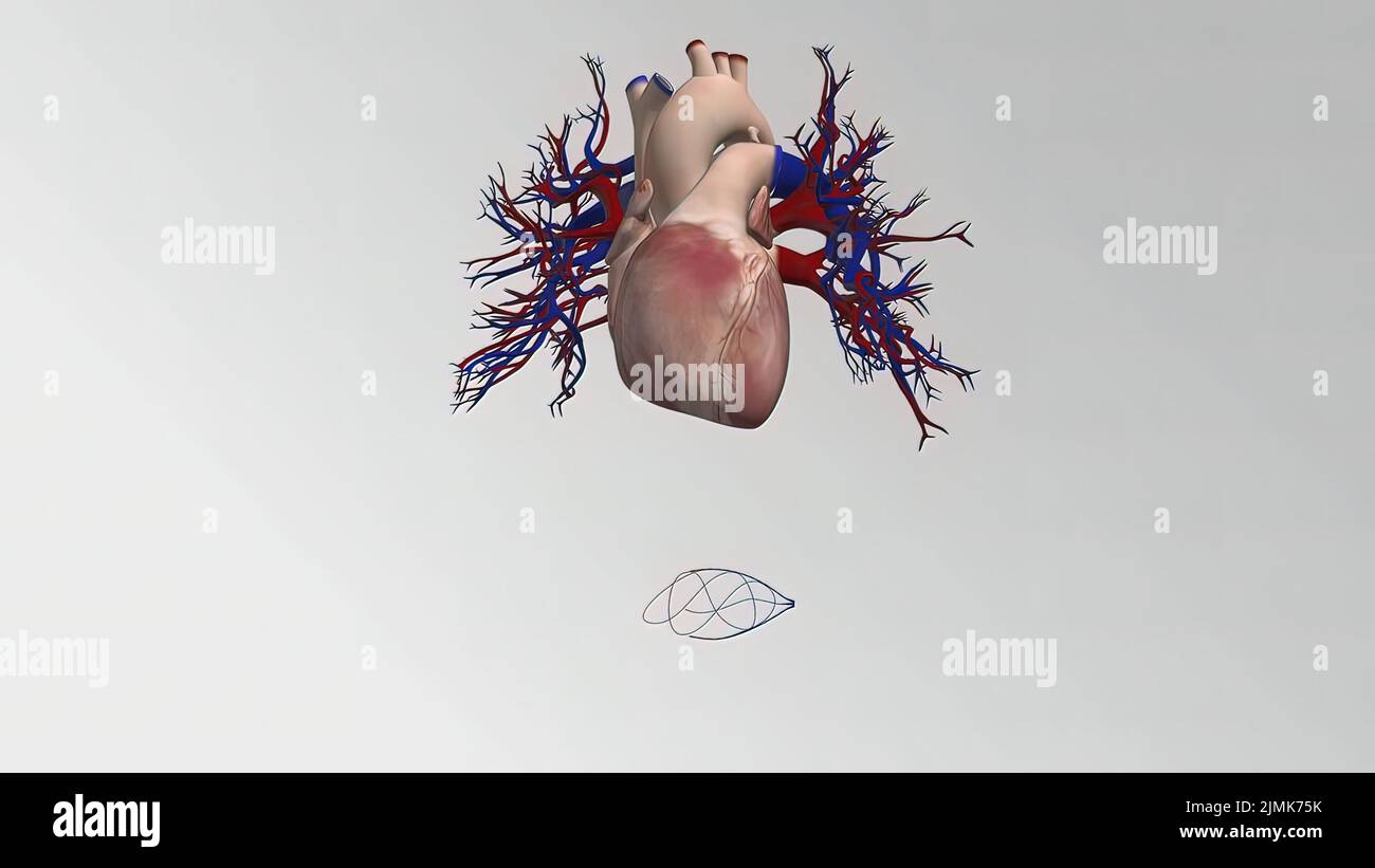 Die Gefäße des Herz-Kreislauf-Systems sind das Herz, die Arterien, die ...