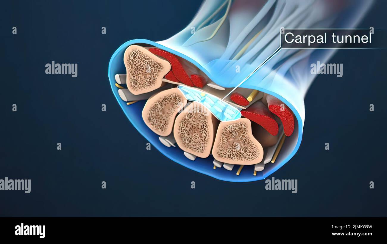 Arm nerven -Fotos und -Bildmaterial in hoher Auflösung – Alamy