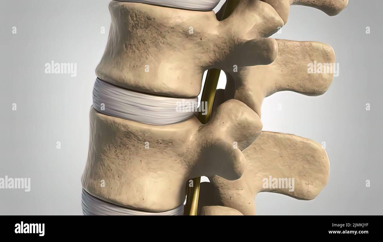 Degenerative joint disease -Fotos und -Bildmaterial in hoher Auflösung ...