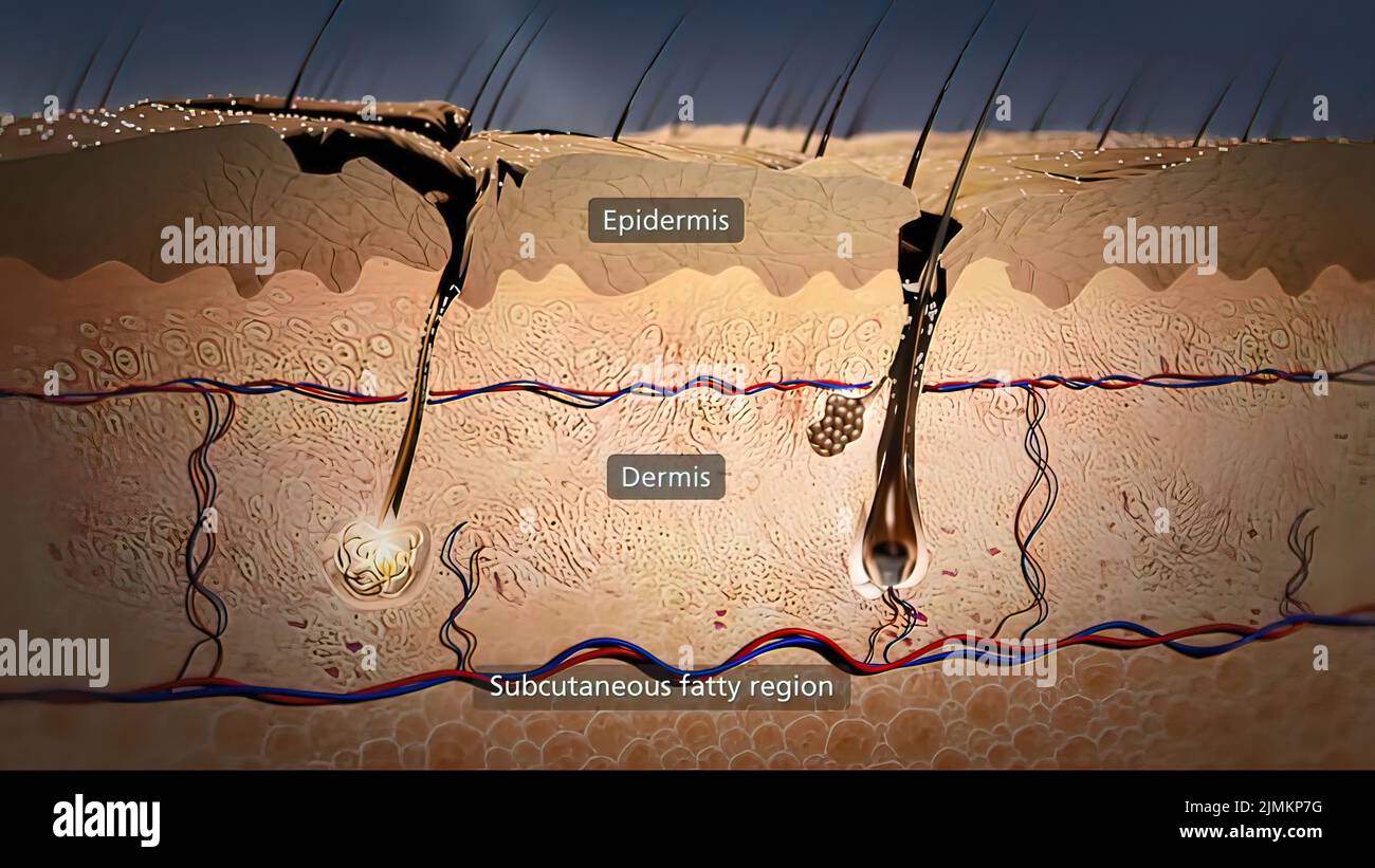 Skin inflammation -Fotos und -Bildmaterial in hoher Auflösung – Alamy