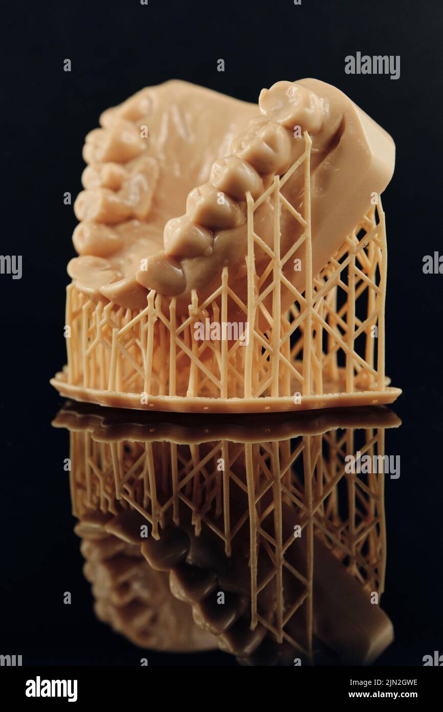 3D Drucken von Zahnkronen und Brückenmodellen. Kieferorthopädisches ...