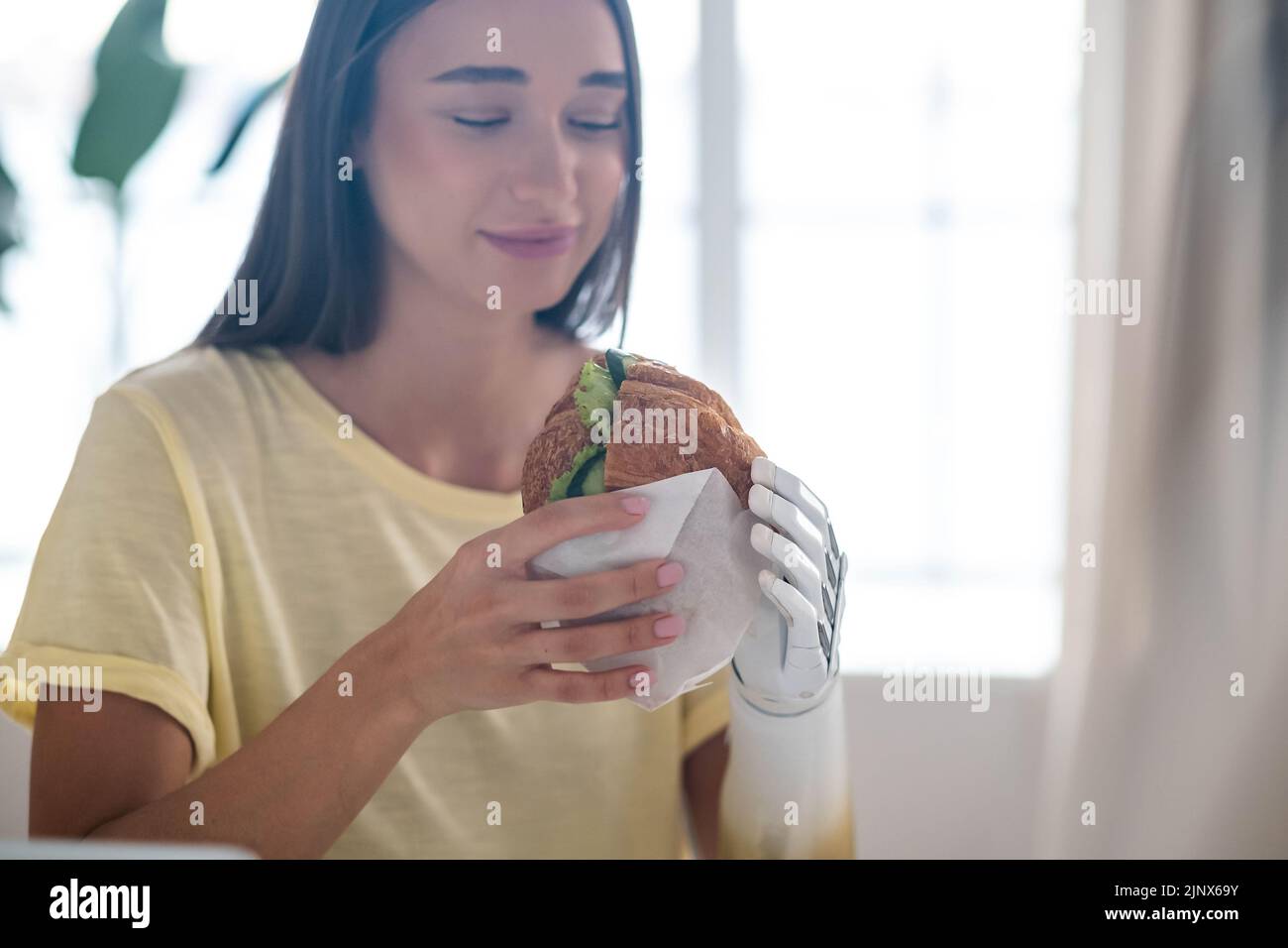 Woman with amputee arm -Fotos und -Bildmaterial in hoher Auflösung ...
