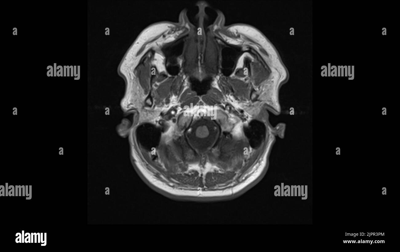 Mri scan serie -Fotos und -Bildmaterial in hoher Auflösung – Alamy