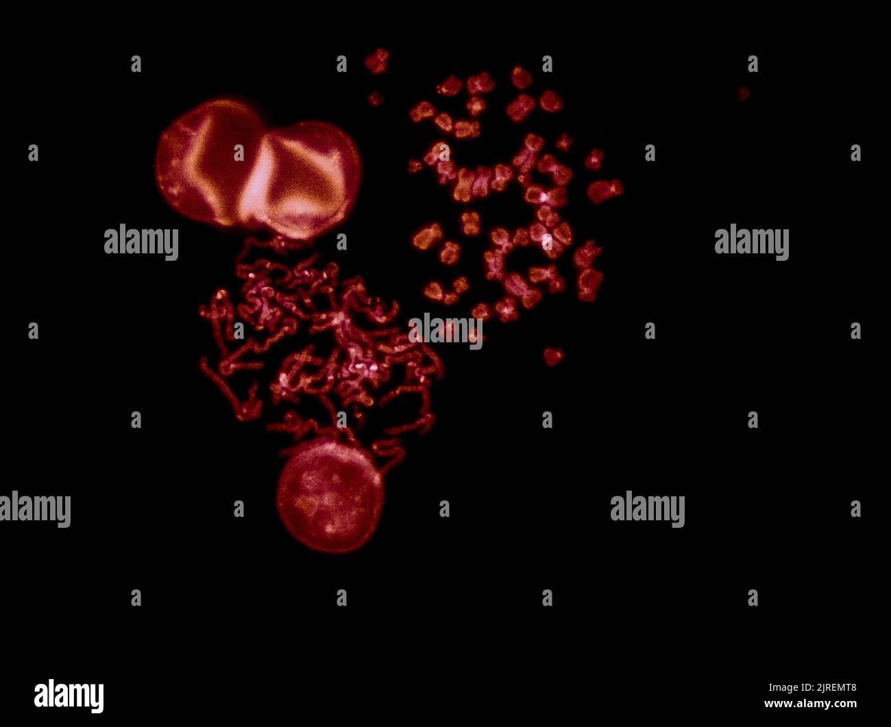 Chromosomen unter Fluoreszenzmikroskop, rot gefärbte menschliche ...