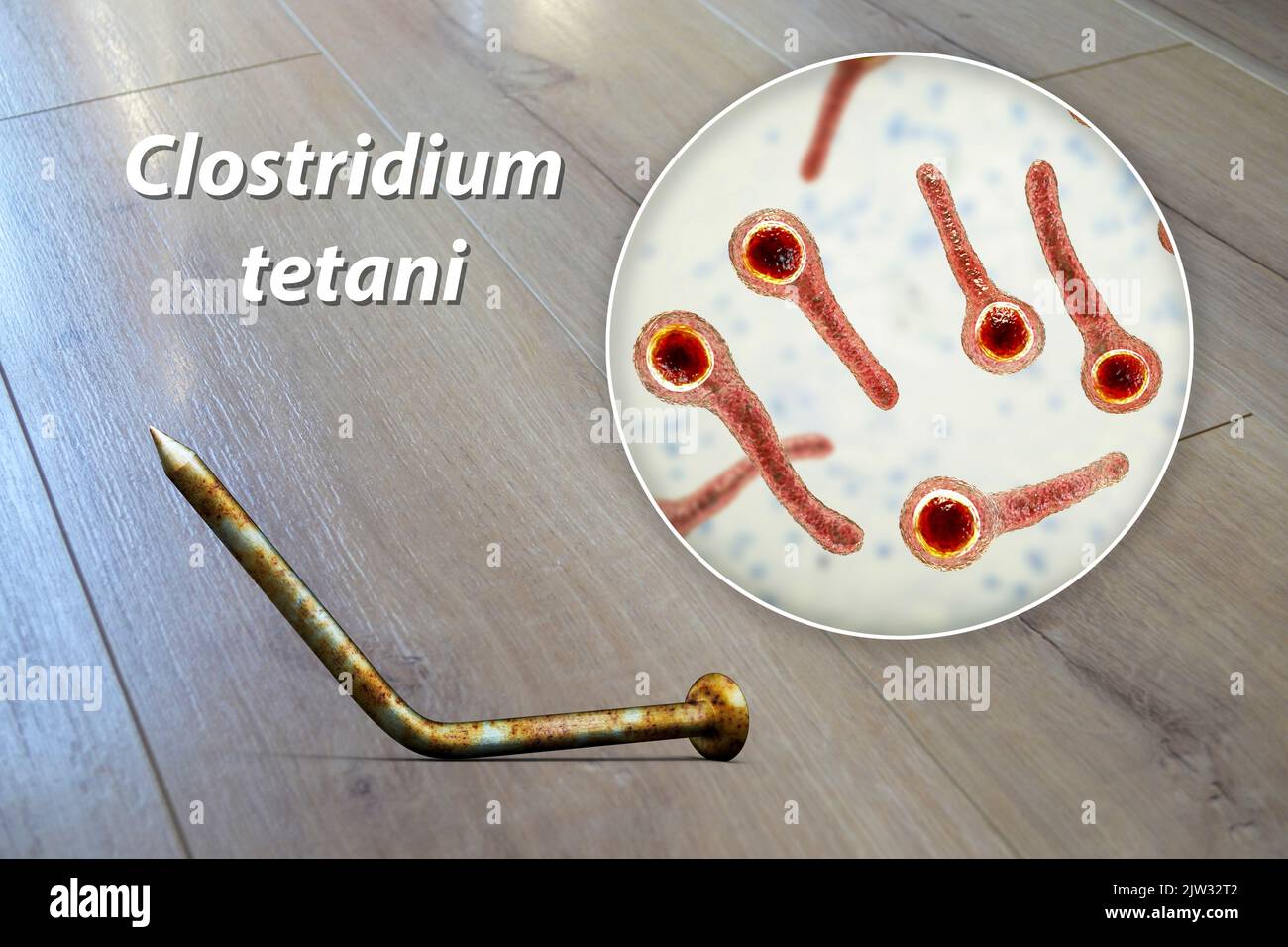 Übertragung von Tetanusbakterien. Konzeptionelle Illustration mit einem ...