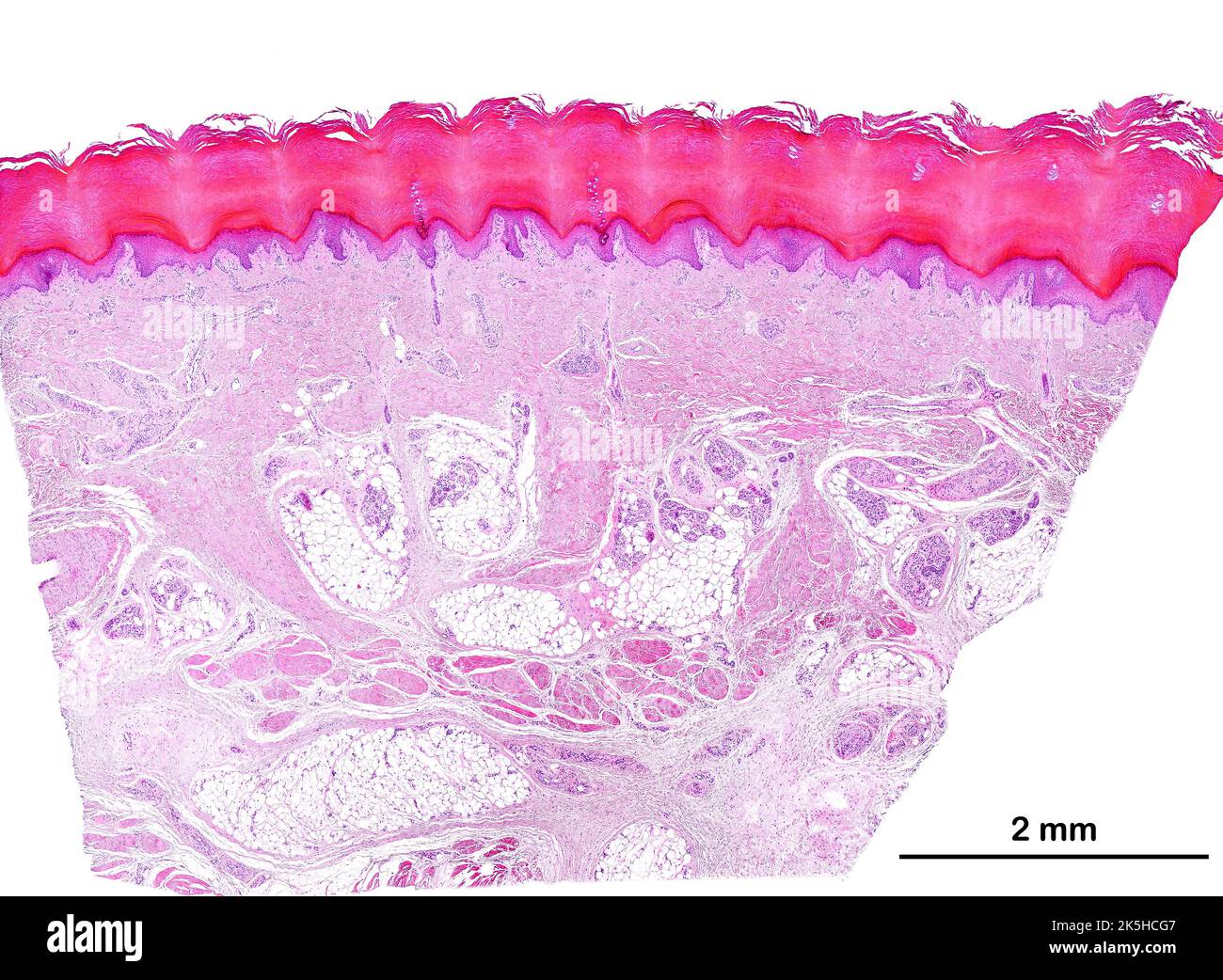 Mikroskopmikroskop mit geringer Leistung der menschlichen glabrosen Haut. Von oben, die ...