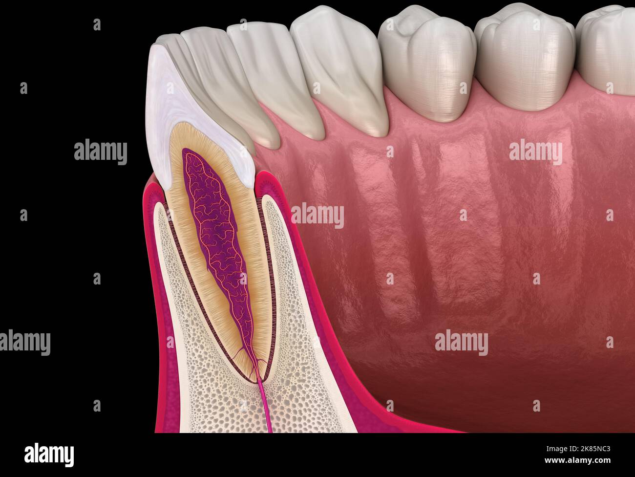 Anatomie des lateralen Schneidezahns und des Zahnfleisches im ...