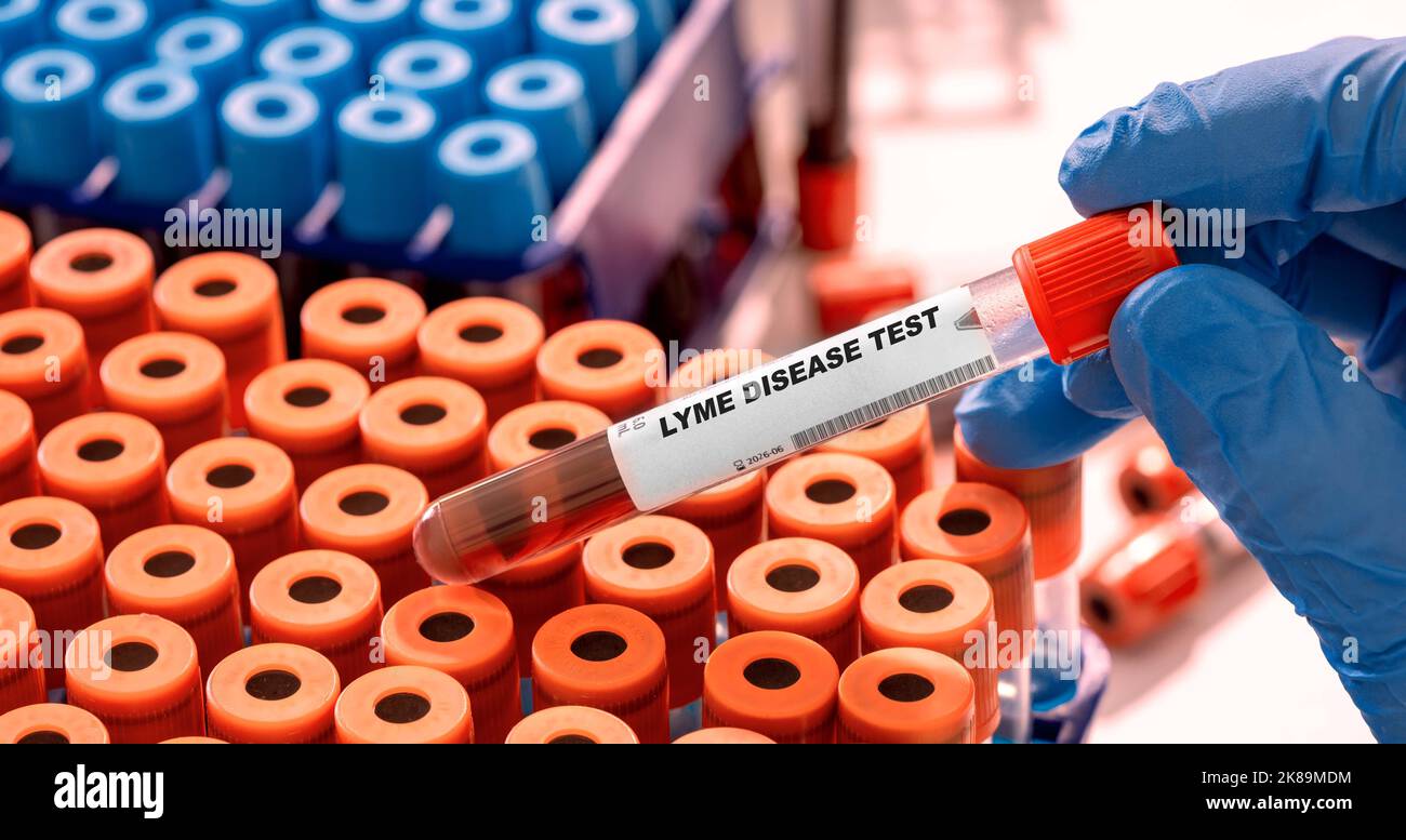 Test de la maladie de lyme -Fotos und -Bildmaterial in hoher Auflösung ...