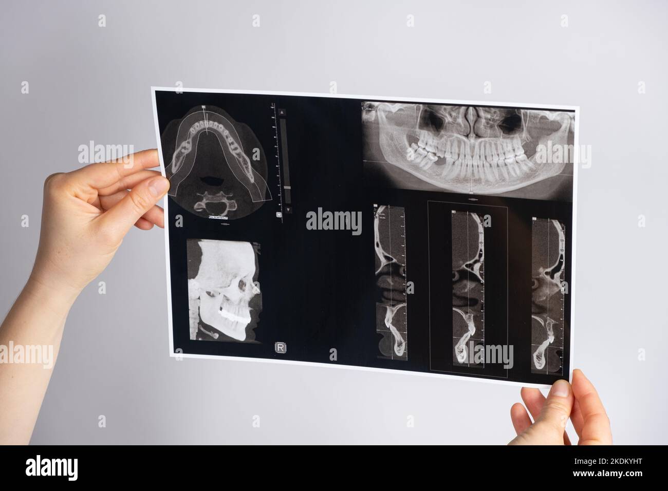 Der Arzt führt einen CT-Scan eines Patienten mit einer Funktionsstörung ...