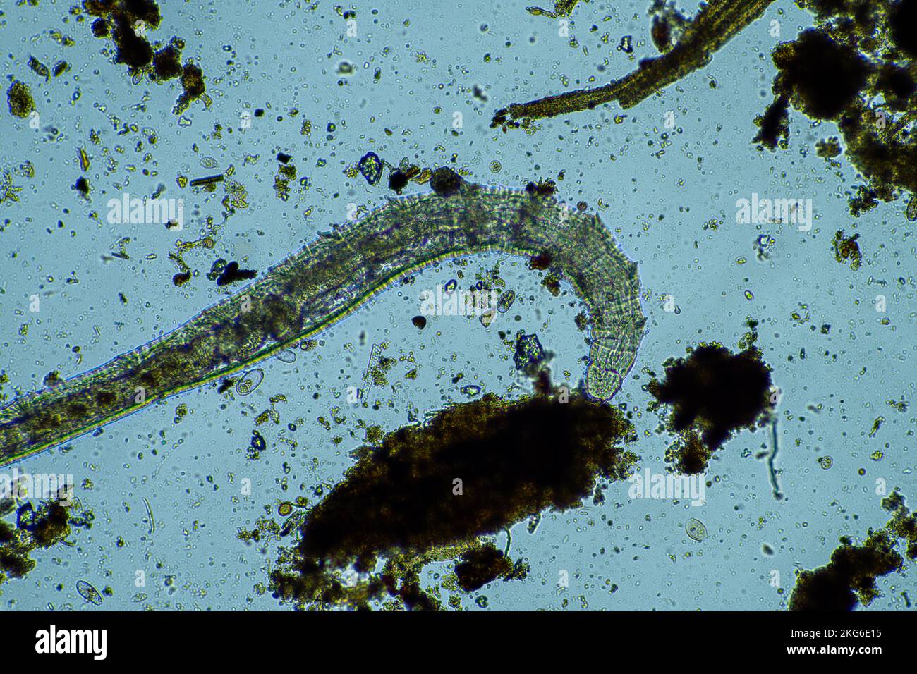 Menschliche Parasiten in der Darmgesundheit des Menschen ...