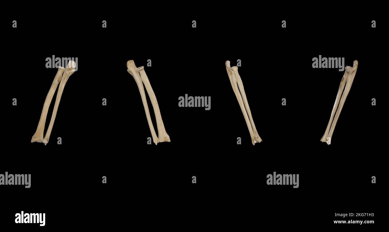 Knochen des unterarms -Fotos und -Bildmaterial in hoher Auflösung – Alamy