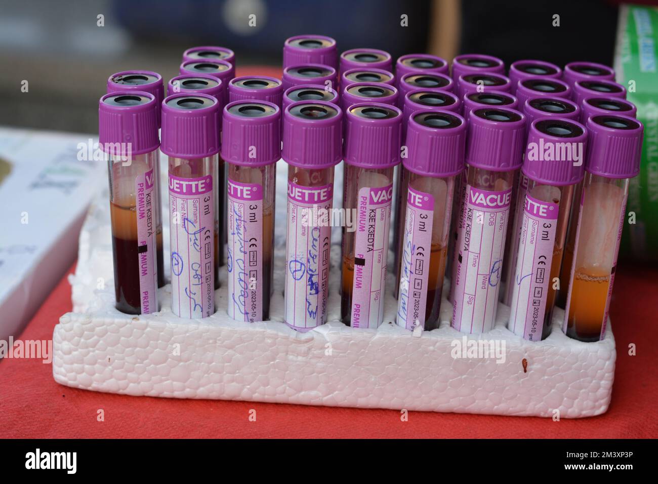 Blutserum röhrchen -Fotos und -Bildmaterial in hoher Auflösung – Alamy