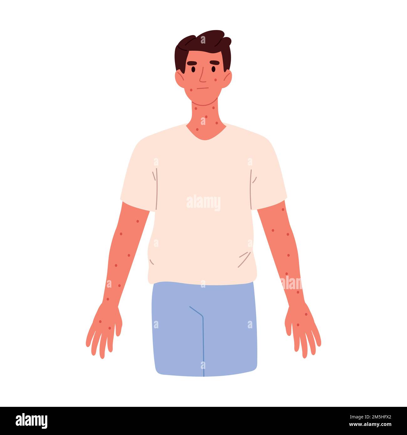 Hautausschlag. Autoimmunerkrankung, Windpocken, atopische Dermatitis ...