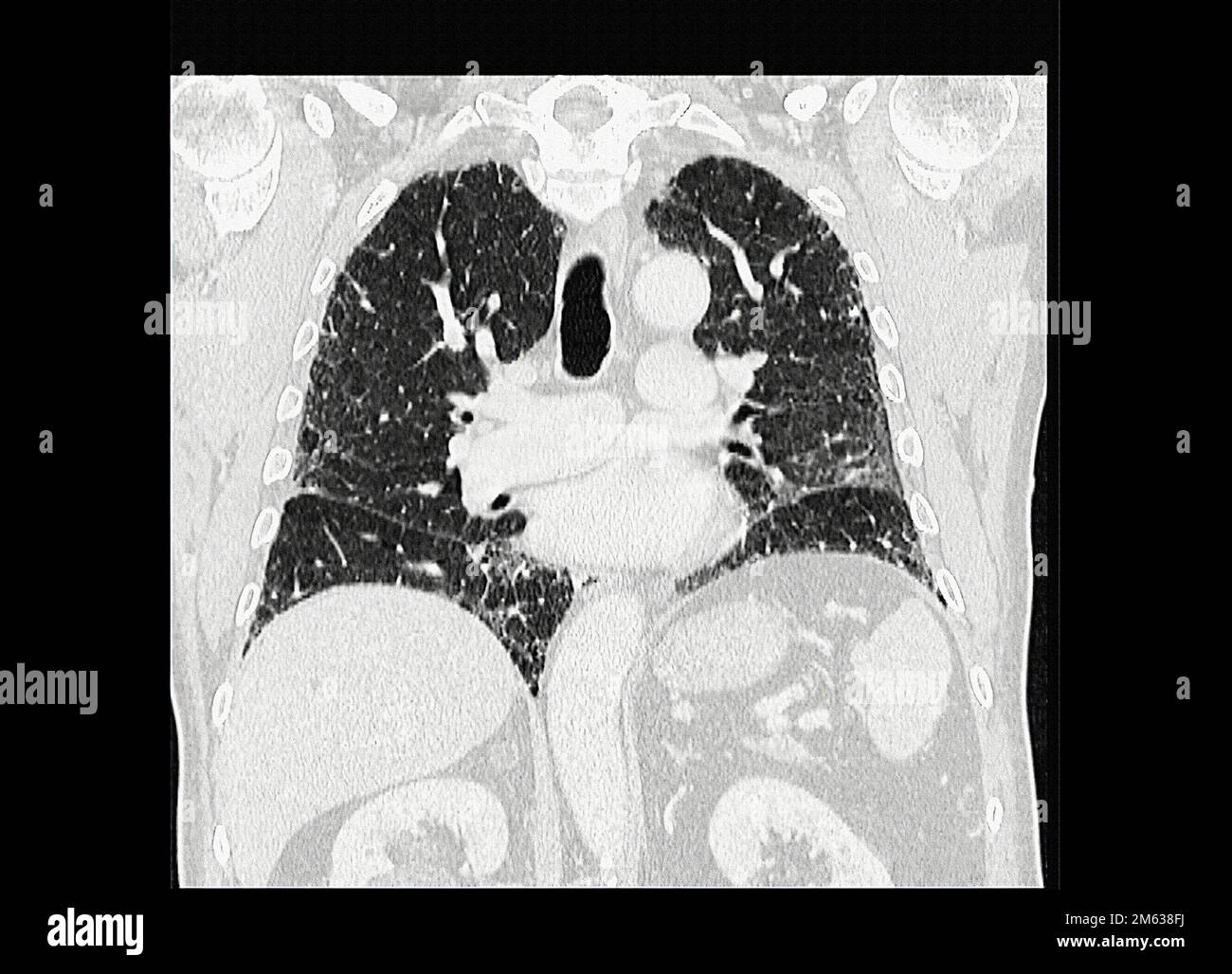 Medical imaging technique -Fotos und -Bildmaterial in hoher Auflösung ...