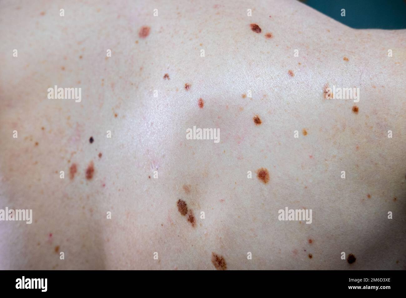 Atypische typen -Fotos und -Bildmaterial in hoher Auflösung – Alamy