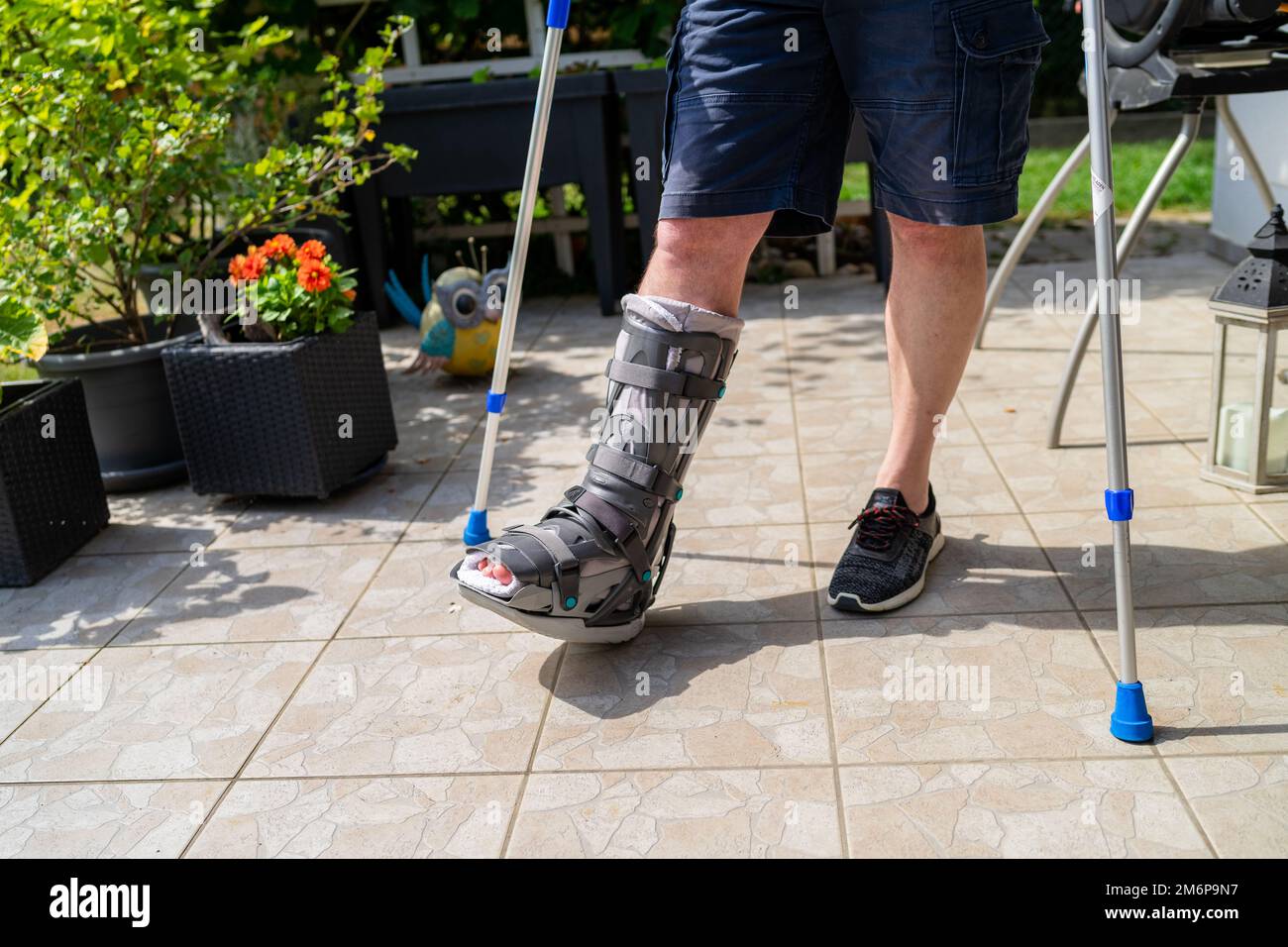Leg in plaster hospital -Fotos und -Bildmaterial in hoher Auflösung ...