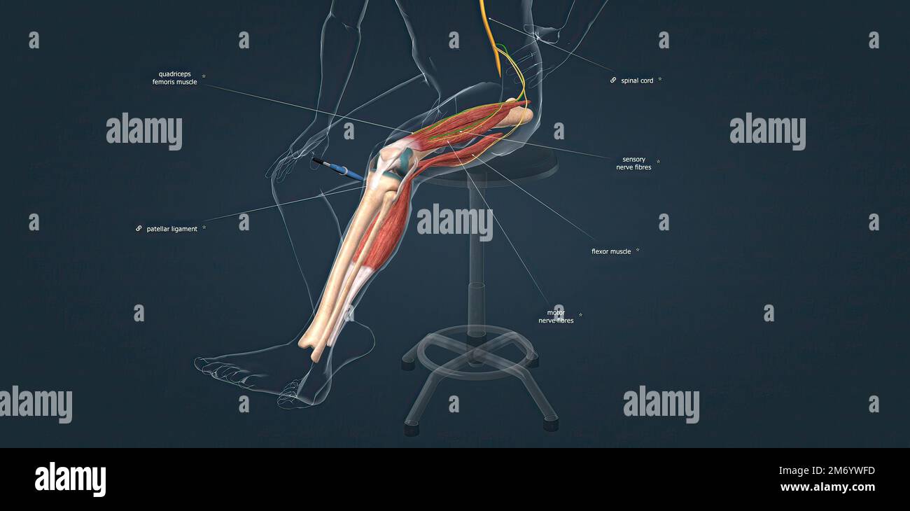 Der Patellarreflex ist ein Reflex, der den Quadrizepsmuskel kontrahiert ...