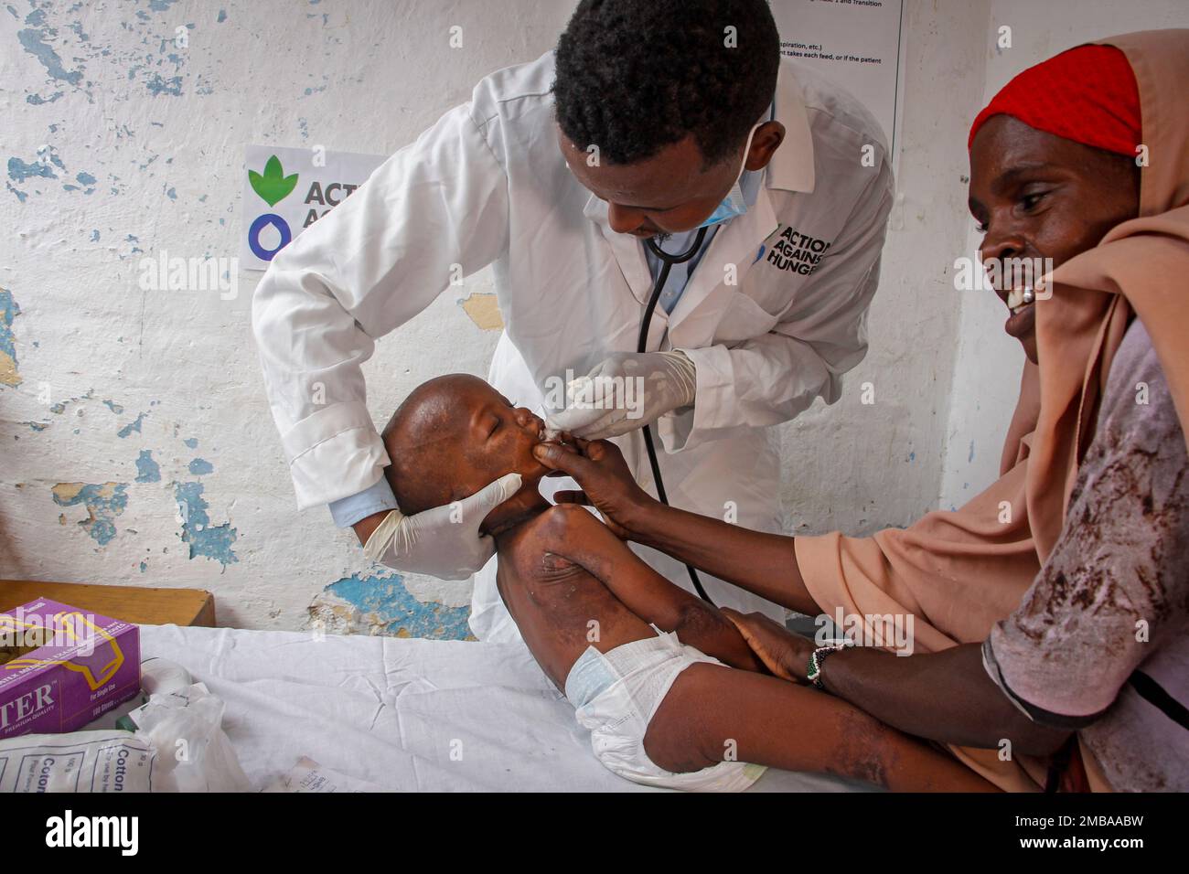 Doctor Mustaf Yusuf treats Ali Osman, 3, who is showing symptoms of ...