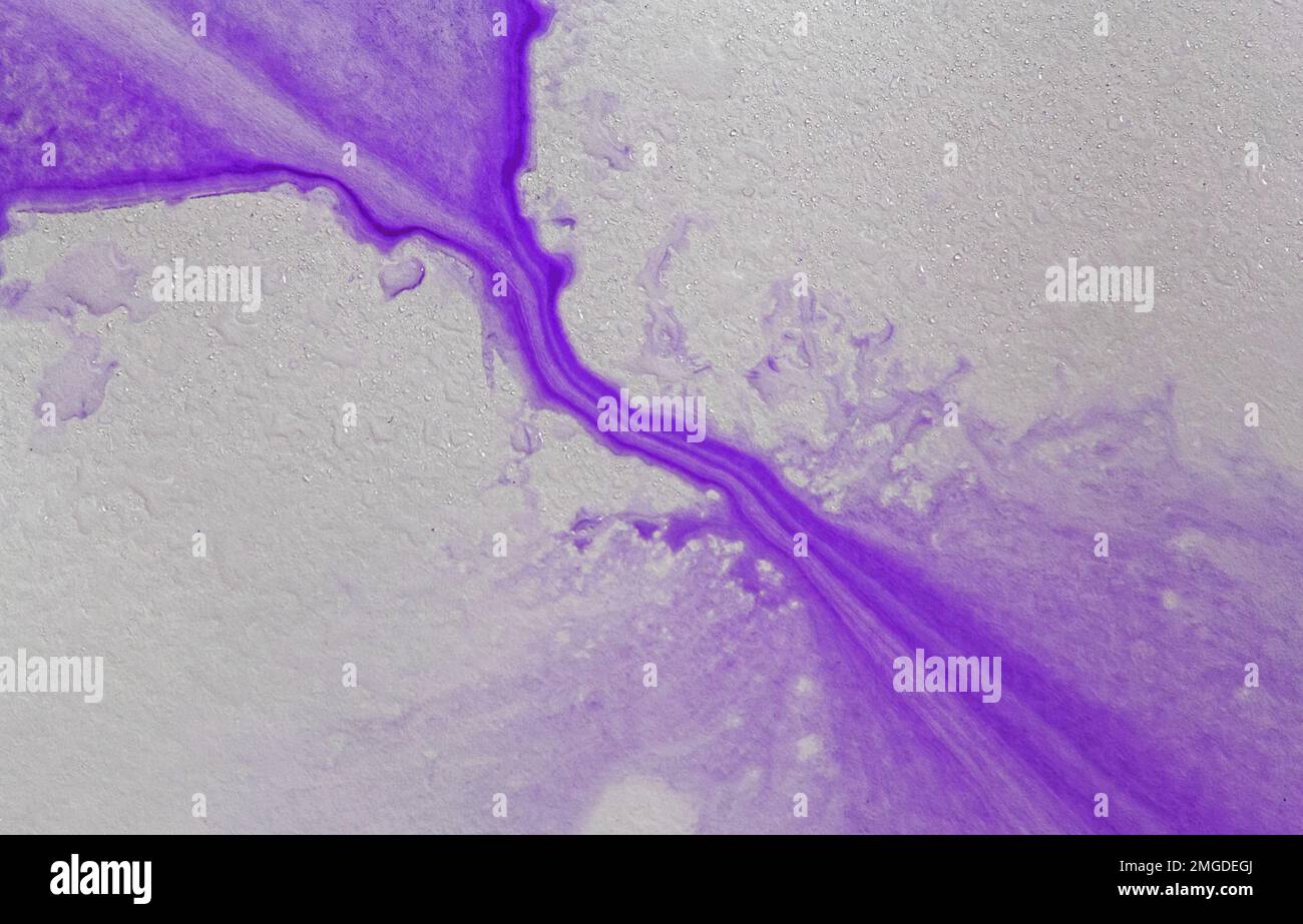 Rote flecken -Fotos und -Bildmaterial in hoher Auflösung – Alamy