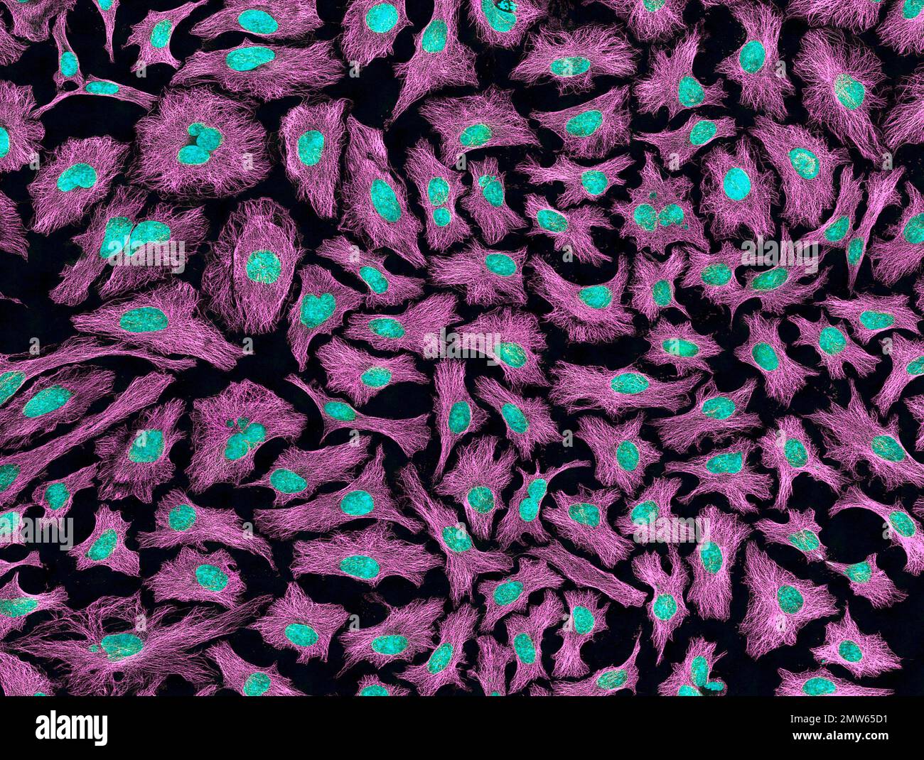 This undated microscope image made available by the National Center for ...
