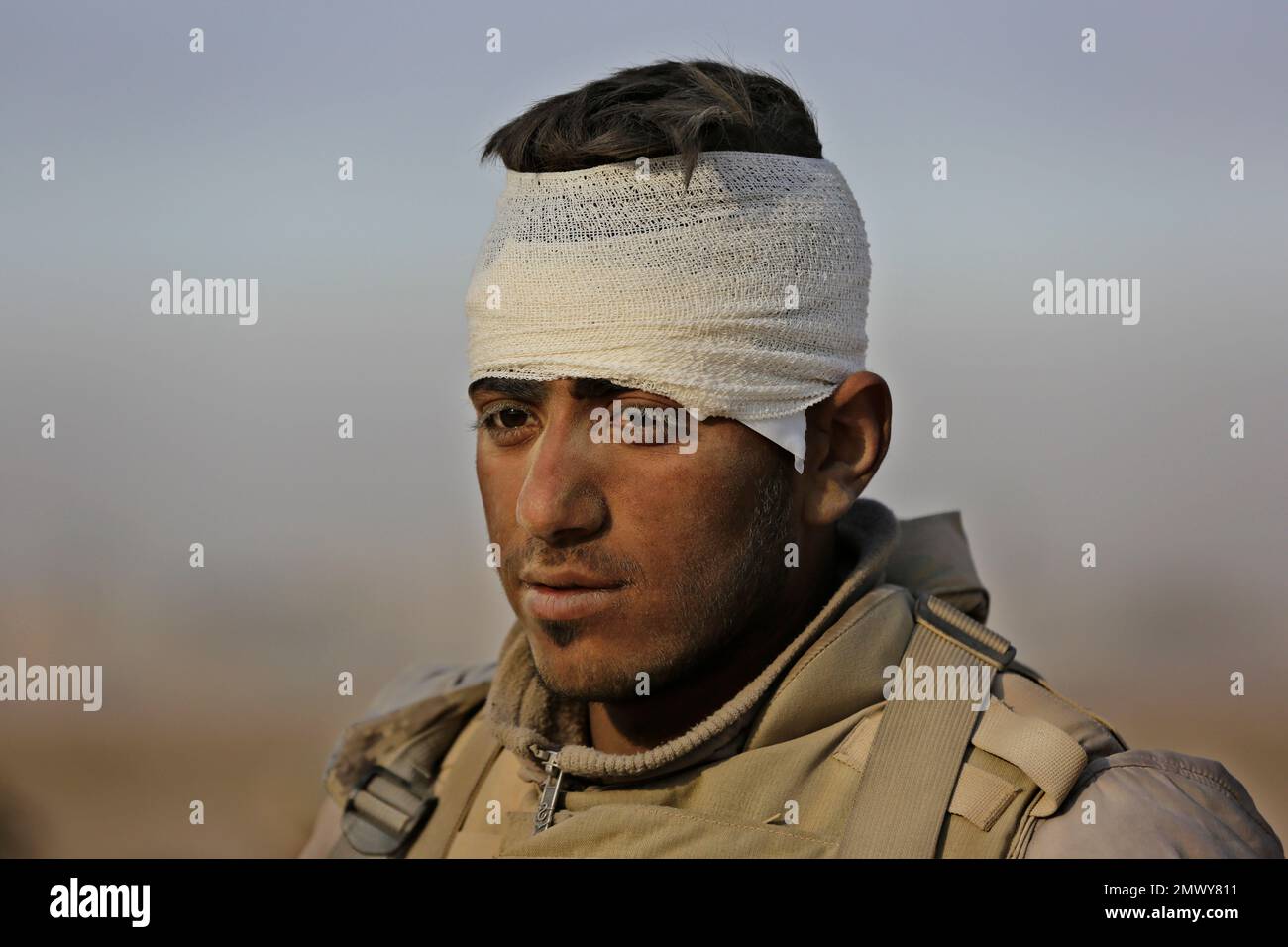 An Iraqi injured soldier who was wounded during the battle against the ...