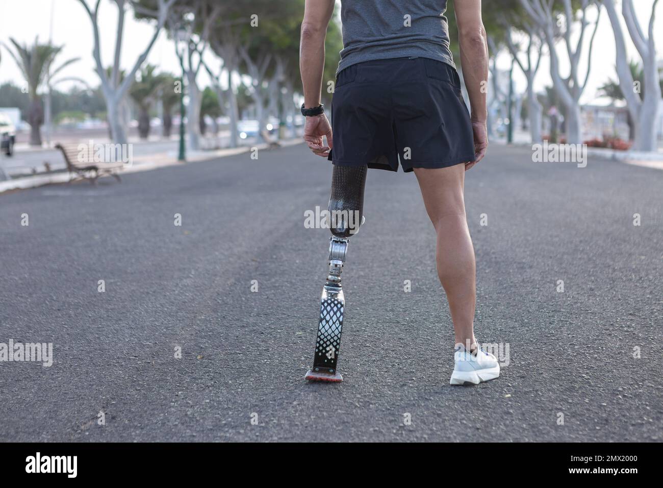 Amputation amputee -Fotos und -Bildmaterial in hoher Auflösung - Seite ...