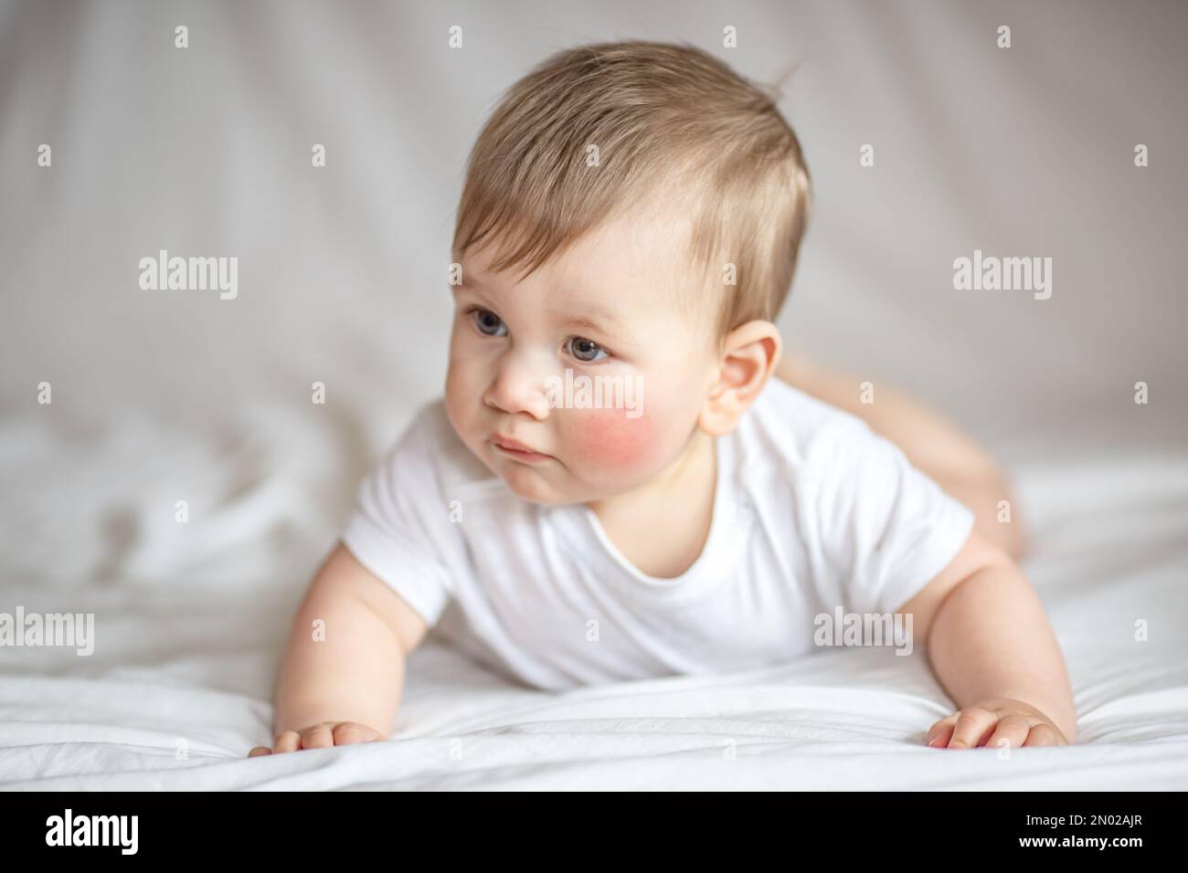 Atopische Dermatitis Ekzem in Baby.Condition, die die Haut zu rot ...