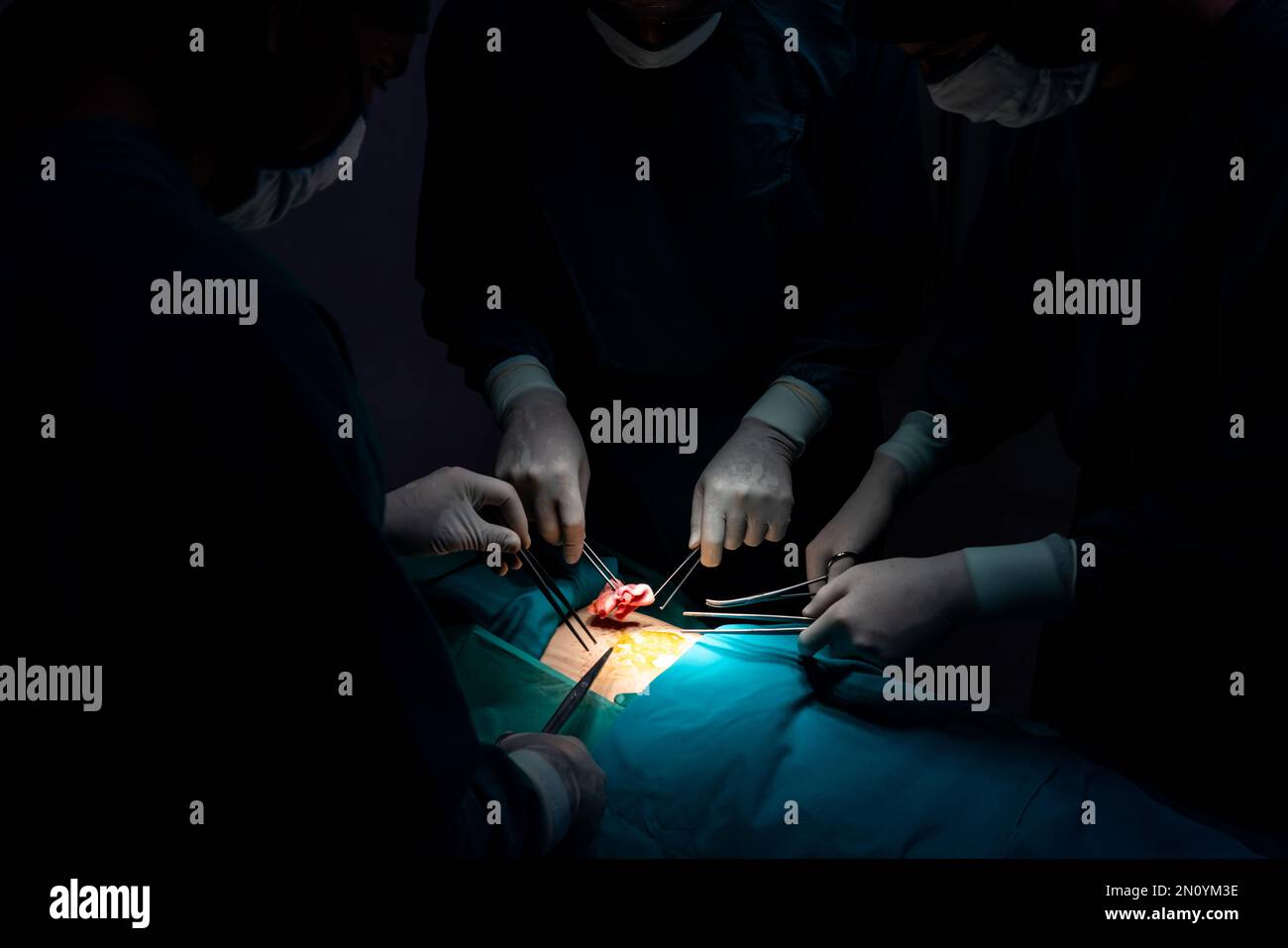 Nahaufnahme Operationsteam, das eine Operation am Patienten im sterilen ...