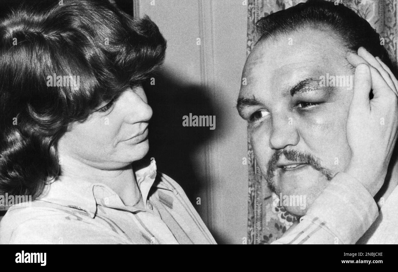 Boxer Chuck Wepner’s head is cradled affectionately by his wife ...