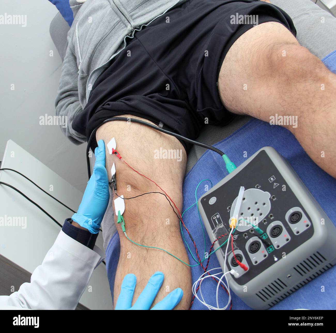 Elektromyographie EMG und Somatosensorisch evoziertes Potential PEV der ...