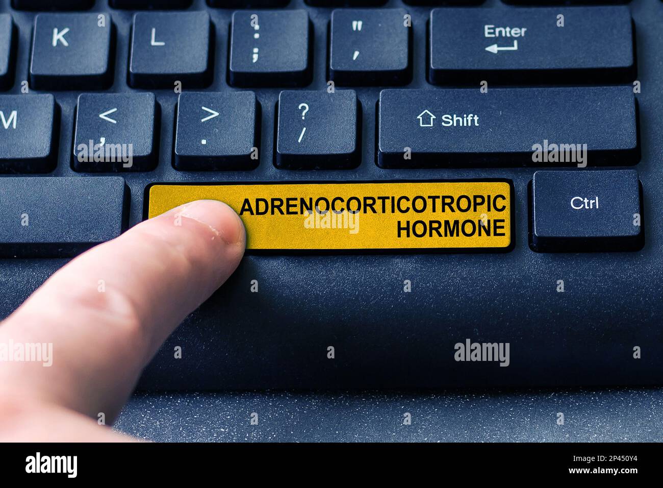 Die Inspiration zeigt Zeichen des adrenokortikotropen Hormons. Durch ... Die Inspiration zeigt Zeichen des adrenokortikotropen Hormons. Durch ...