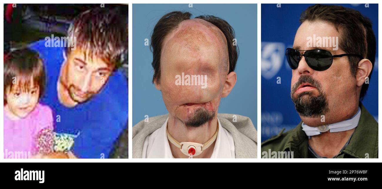 This three-photo combination shows Dallas Wiens, the recipient of the ...