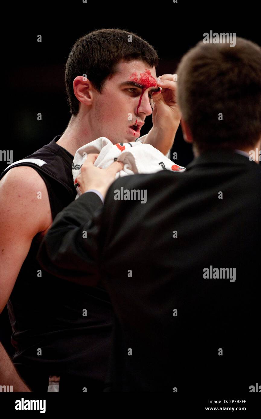 December 20 2010: Davidson's center Jake Cohen (15) sustains a cut over ...