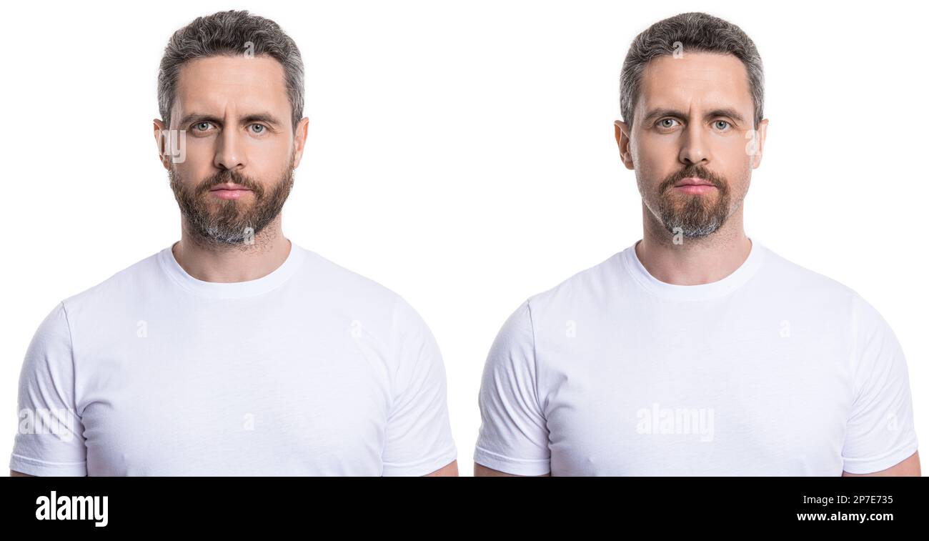 Zwei Männer mit Bart im Vergleich vorher und nachher im Studio. Mann ...