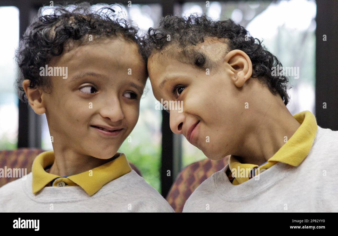Twin brothers Mohamed Ibrahim, right, and Ahmed Ibrahim touch heads during an interview in ...
