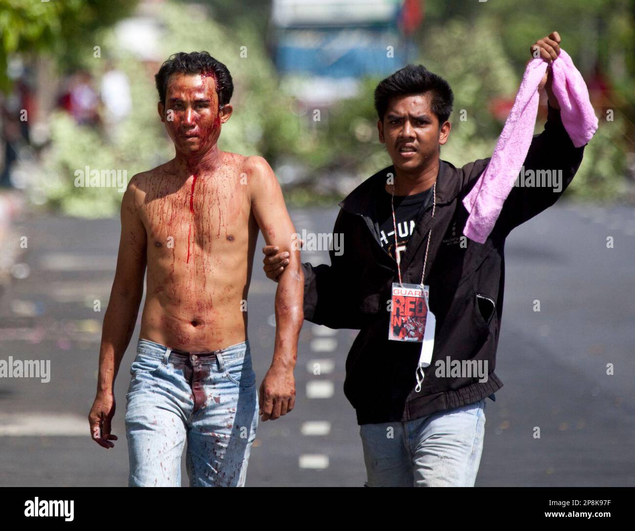 An unidentified man with a head injury walks through police lines to a ...