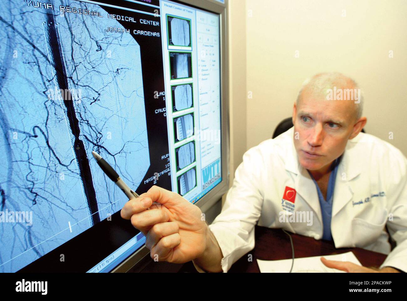 Dr. Joseph Cardenas, heart surgeon, explains how the new stent, which ...