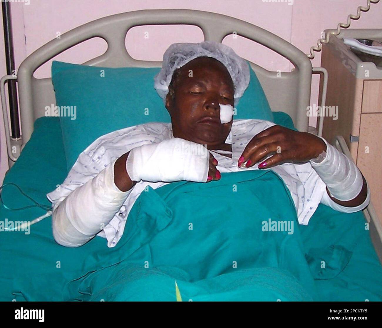 British tourist Suzanna Beckford rests in a hospital bed in Marmaris ...