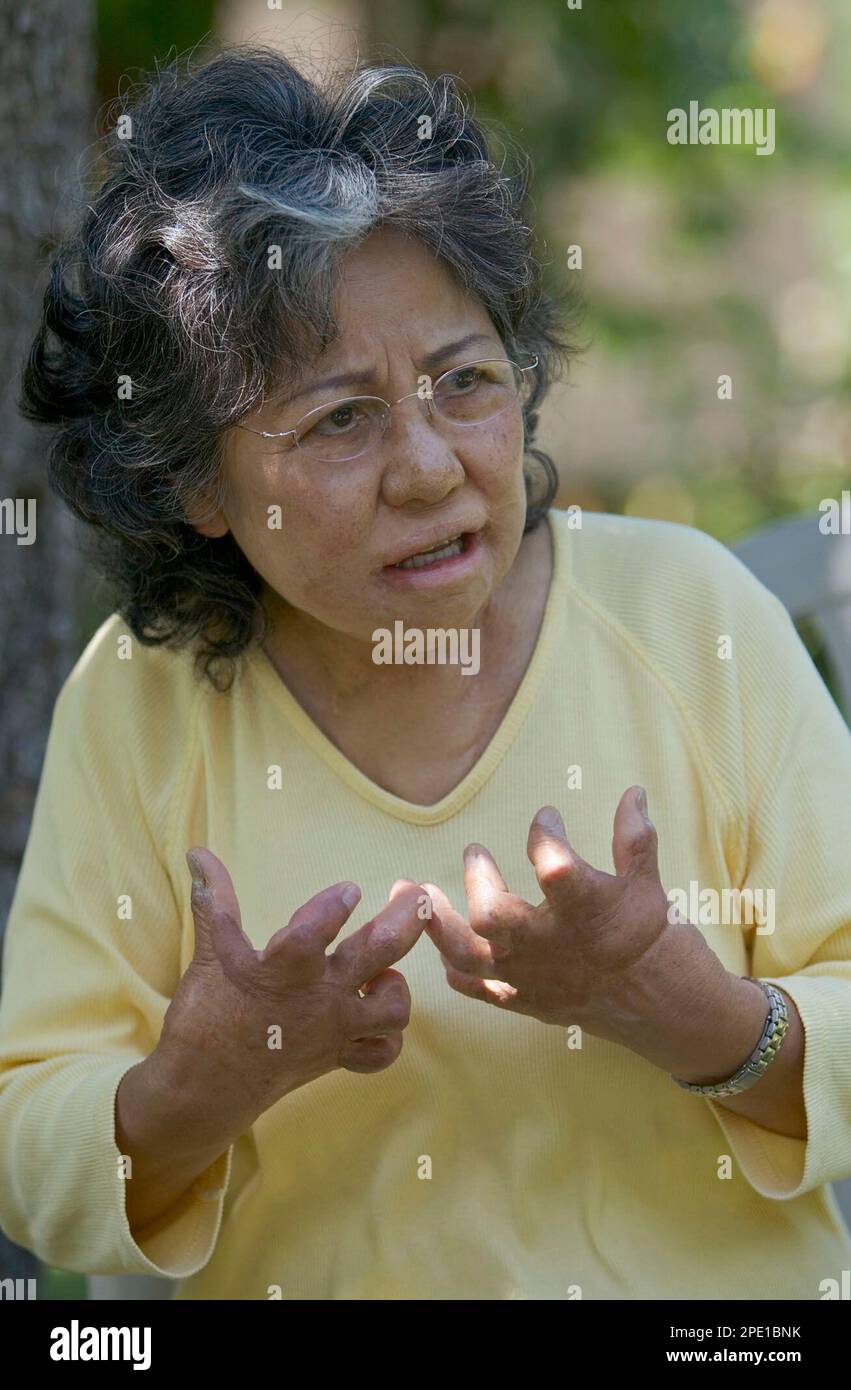 Hiroshima survivor Shigeko Sasamori, 73, recounts the day, sixty years ...