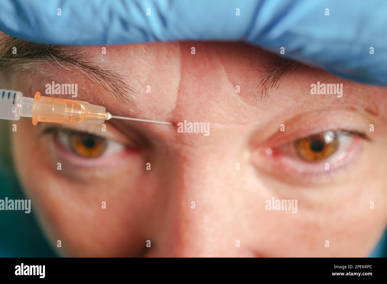 Botox behandlung -Fotos und -Bildmaterial in hoher Auflösung – Alamy