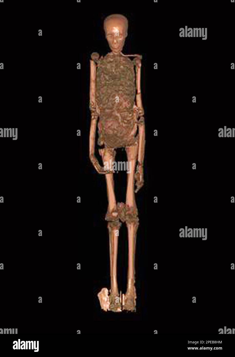 A picture released by Egyptian antiquities authority showing CT scan ...
