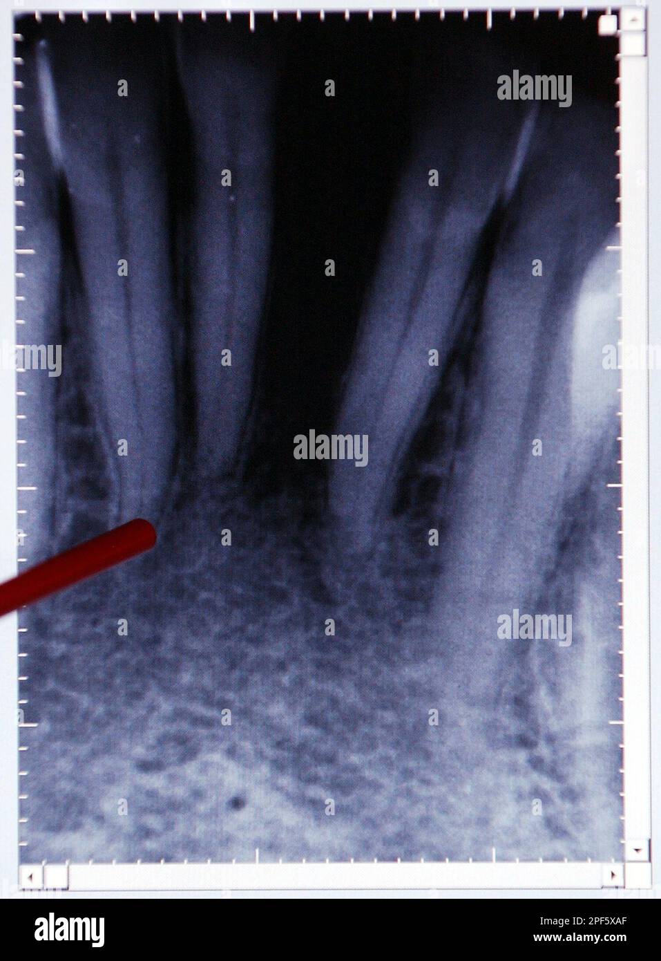 A military official uses a pointer to indicate a missing tooth in this ...