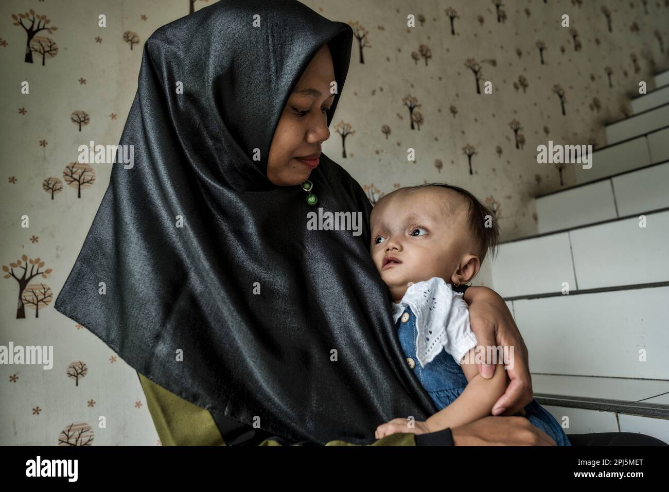 Leben hydrozephalus -Fotos und -Bildmaterial in hoher Auflösung – Alamy