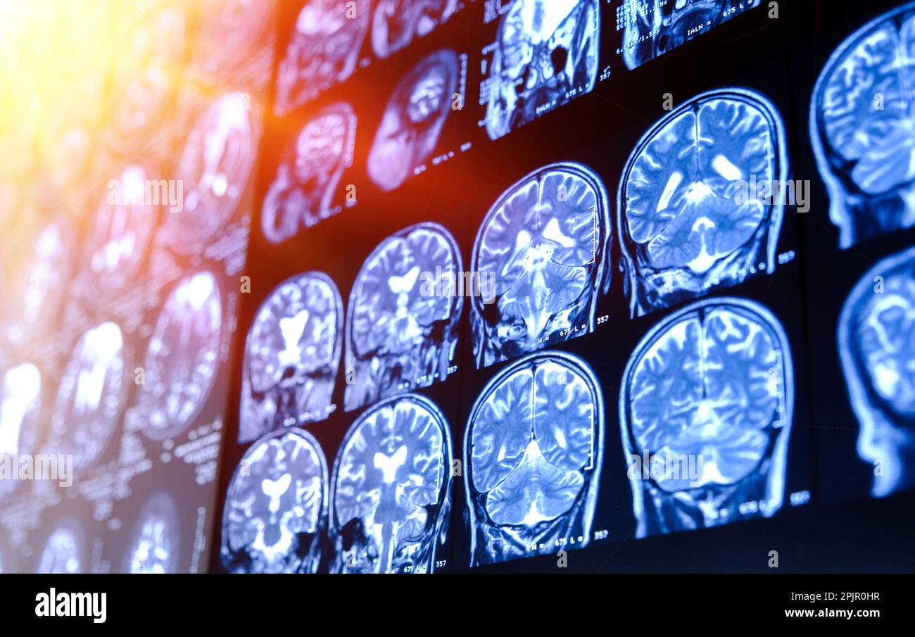 Ct scan radiographie xray -Fotos und -Bildmaterial in hoher Auflösung - Seite 2 - Alamy