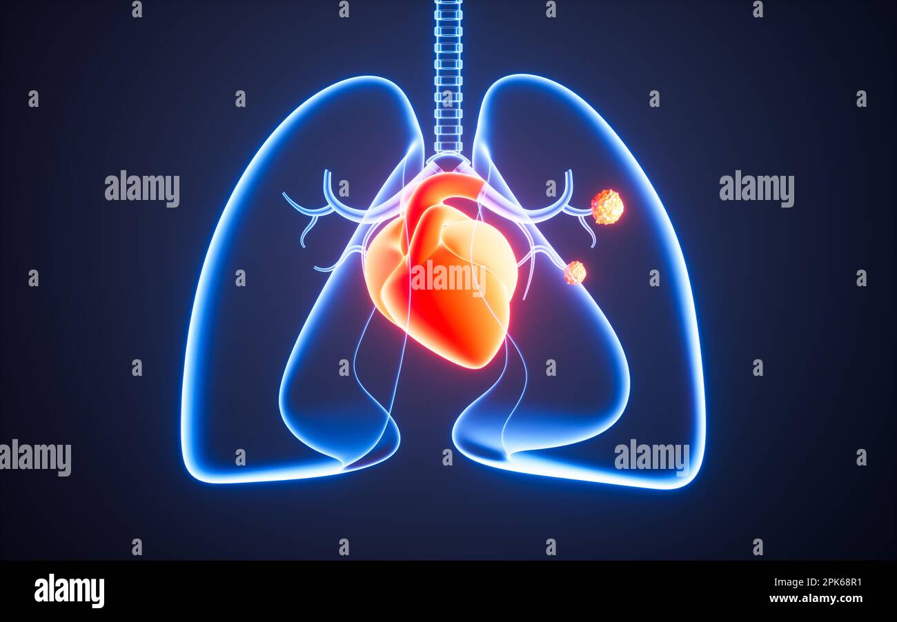 Venas pulmonares 3d -Fotos und -Bildmaterial in hoher Auflösung - Seite ...