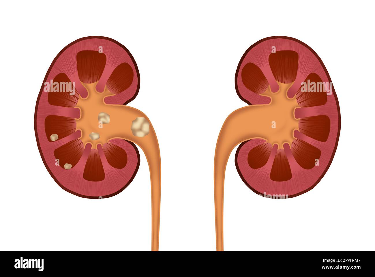 Nierenstruktur und funktion -Fotos und -Bildmaterial in hoher Auflösung ...