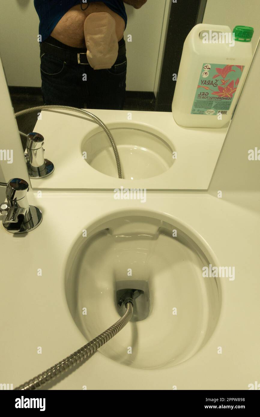 Mann stoma ileostomie kolostomiebeutel toilettenentleerung -Fotos und ...