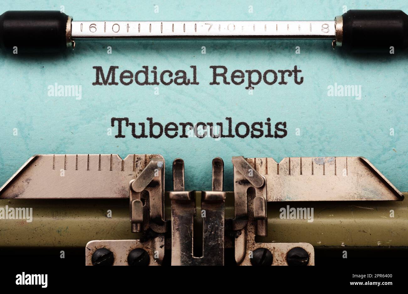 Tuberkulose behandlung -Fotos und -Bildmaterial in hoher Auflösung – Alamy